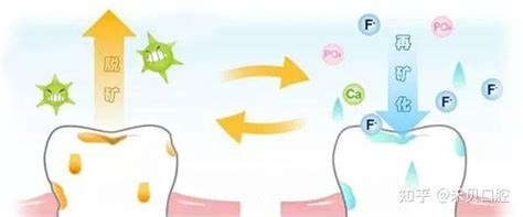 如何促进牙齿再矿化？ 知乎