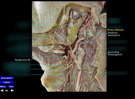Face Infratemporal Fossa Pharynx Retropharynx Nasal Cavity And Mouth Image 5 Exam 1