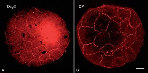 Figure 3 8 From Structure And Function Of Desmosomes Semantic Scholar