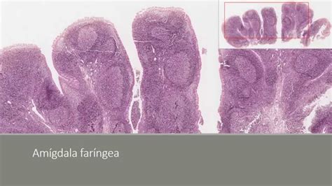 tejido linfático histología YouTube