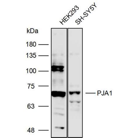Solarbio K111759p Anti Pja1 Polyclonal Antibody 试剂仪器耗材
