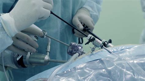 Laparoscopy Pelvic Uses Risks And Benefits