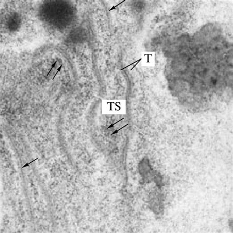 A Fragment Of A Cyanobiont Protoplast Near The Coralloid Root Apex Of Download Scientific