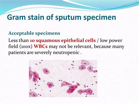 Sputum Sample Processingpptx