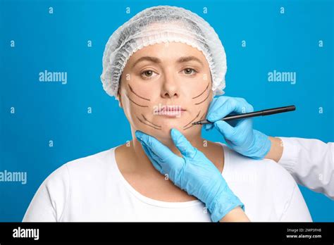 Doctor Drawing Marks On Womans Face For Cosmetic Surgery Operation