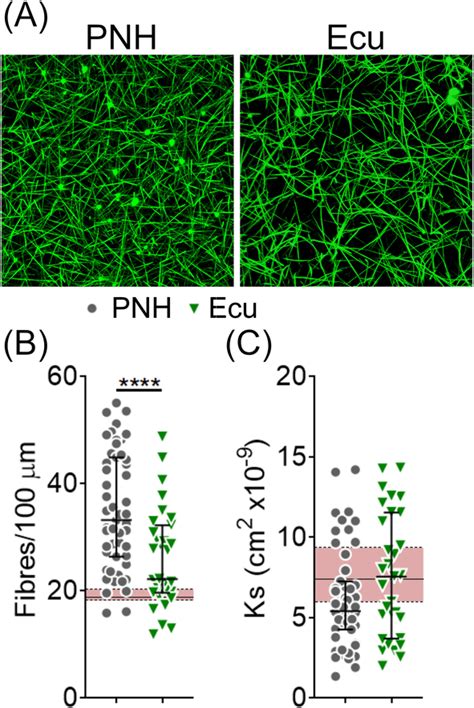 The Effects Of Eculizumab Treatment On Clot Structure A Download