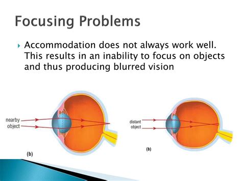 Ppt 123 The Human Eye Powerpoint Presentation Free Download Id2109563