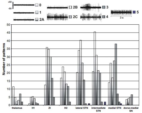 electrophysiological data top classification of typical patterns