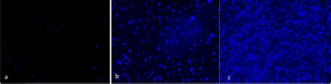 Dapi Nuclear Staining Was Used To Determine Apoptosis In Molt4 Cells