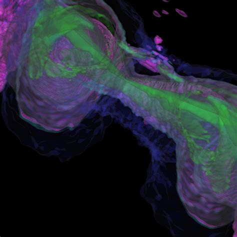 Volume Rendering Maximum Intensity Projection And Isosurfaces