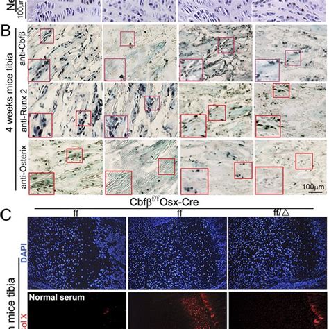 cbfβ deficiency decreases chondrocyte proliferation reduces expression