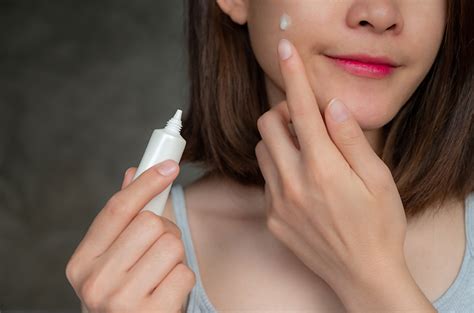 Rekomendasi Salep Penghilang Bekas Jerawat Yang Ampuh