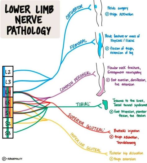 Why Is Bilateral Sciatica A Red Flag And How Is It Diagnosed Bilateral