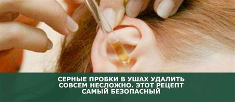 Серные пробки в ушах удалить совсем несложно Этот рецепт самый