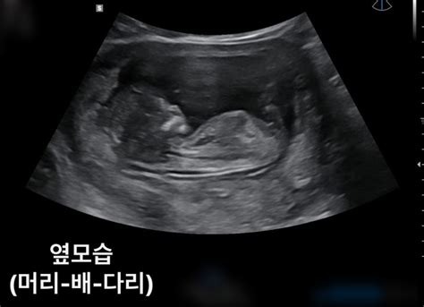 임산부 태아검진휴가 일자 계산 스프레드 시트 공유 법령첨부 네이버 블로그