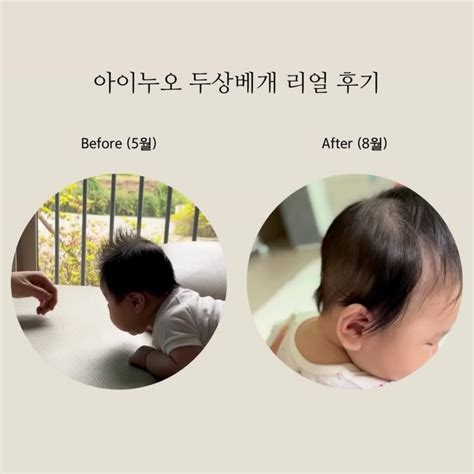 투하맘 임신출산 • 육아꿀팁 • 육아정보 공구오픈 매일 누워만 있는 두찌 두상이 예쁠 수 있는 이유🩷 국민 두상베게 아이누오 베개 하세요 🎁 구매완료 이벤트