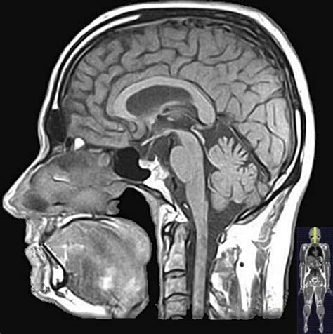 Imaging Examples