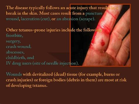 Tetanus