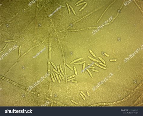 Fusarium Solani Spores