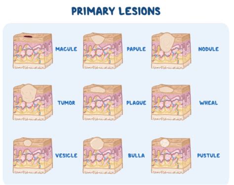 Week 7 Abdomen Gi Gu Flashcards Quizlet