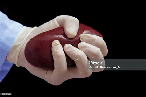 지 하 신장 이식 수술 개념입니다 불법 장기 이식입니다 인간의 신장 이식 외과 의사의 손에입니다 시신 기증자 신장 국제 신장 하루 휴가 혈액 투 석을 중지 콩팥 내부 기관에