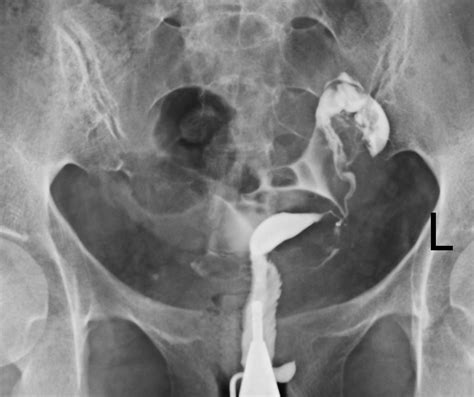 Image Radiopaedia Org