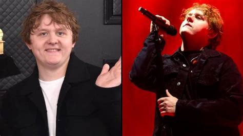 Uk News Lewis Capaldi Announces He Has Tourettes Syndrome