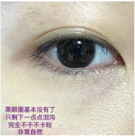 哪款平價遮瑕最好用？怎麼挑選平價遮瑕？熱門遮瑕液的真實測評 每日頭條