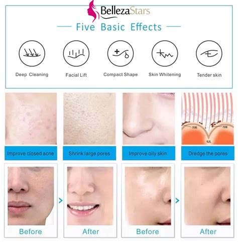 Hydra Dermabrasion Rf Bio Lifting Spa Facial Machine Beauty Machine