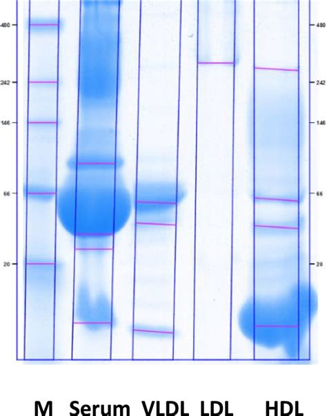 Isolation Of Human Hdl And Ldl Particles By Differential Download