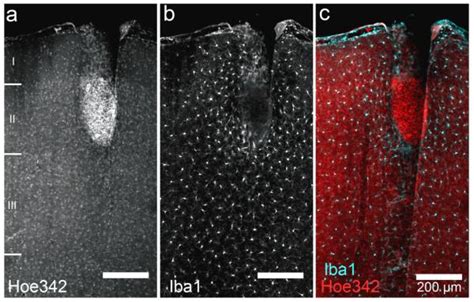 Chronic Intracortical Microelectrode Arrays Induce Non Uniform Depth Related Tissue Responses Pmc