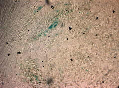 How Would You Give A Percentage To Stained Cells Versus Total Cells
