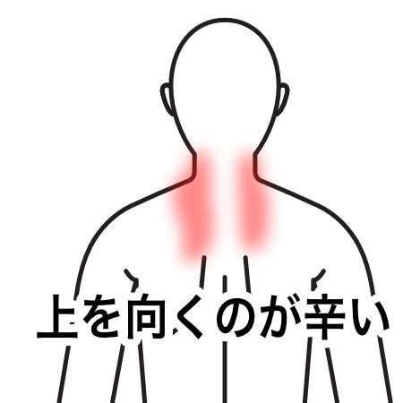 肩こりで上を向くのが辛い肩こり首こりのツボツボネット 鍼灸の症例が検索できるツボ辞典