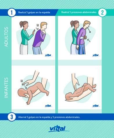 Cómo hacer la maniobra de Heimlich la técnica que en el 90 de los