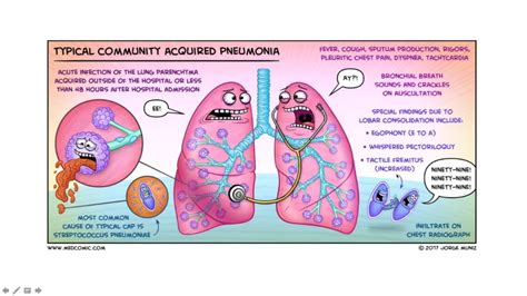 Algorithm 47 Pneumonia Youtube