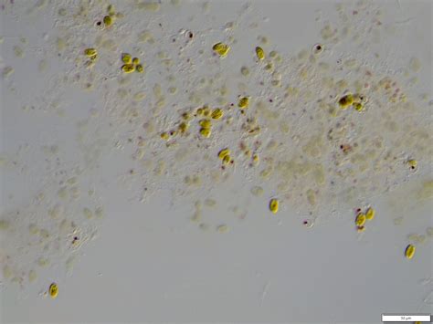 Algae Processed Noisy Object Detection Dataset By Stuff