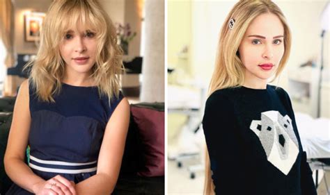 Schock GNTM Model Theresia Fischer zeigt Beinverlängerung