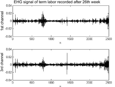 Figure 4 From The Hilbert Transform In Analysis Of Uterine Contraction Activity Semantic Scholar