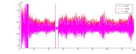 Eeg Signal Neural Network Download Scientific Diagram