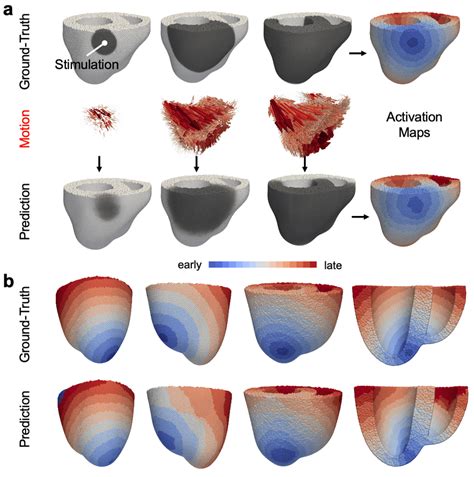 Electrical Activation Maps Computed From Ventricular Motion Using Deep Download Scientific