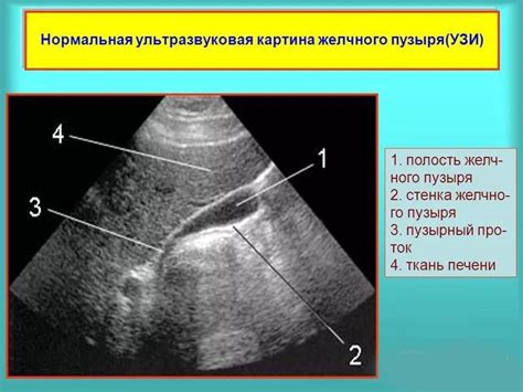 Стол при заболевании печени и желчного пузыря 90 фото