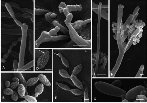 Conidiophore And Conidia Morphology Of Species Of Cladosporium Under