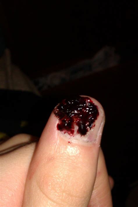 Casualty Simulation Makeup