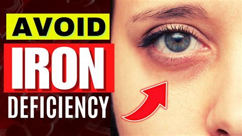 Iron Deficiency Anemia Eyes