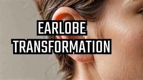 Stunning Earlobe Surgery Transformation Before And After Youtube