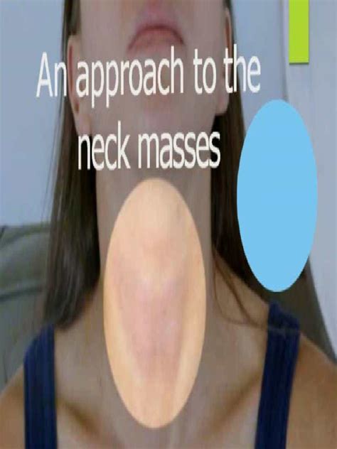 Approach To Neck Masses 3 Pdf