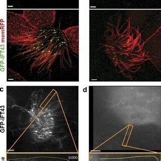 Fuz Is Required For The Localization Of Anterograde But Not Retrograde Download Scientific