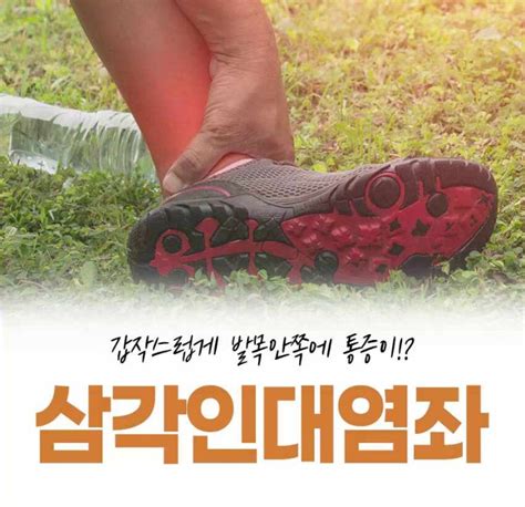 수락산역정형외과 갑작스러운 발목통증은 삼각인대염좌 네이버 블로그