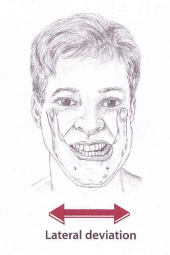 Balance Tmj And Forward Head Posture