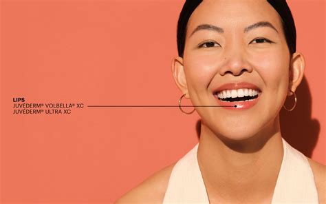 Juvederm Lips